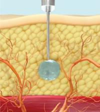 Formulation | Somatuline® Depot 120mg Injection | HCP