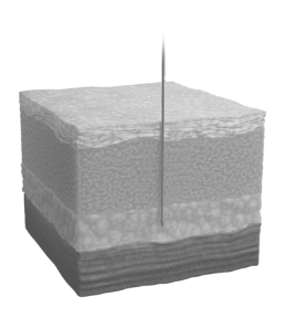 Dosing and Administration | Somatuline® Depot 120mg Injection | HCP